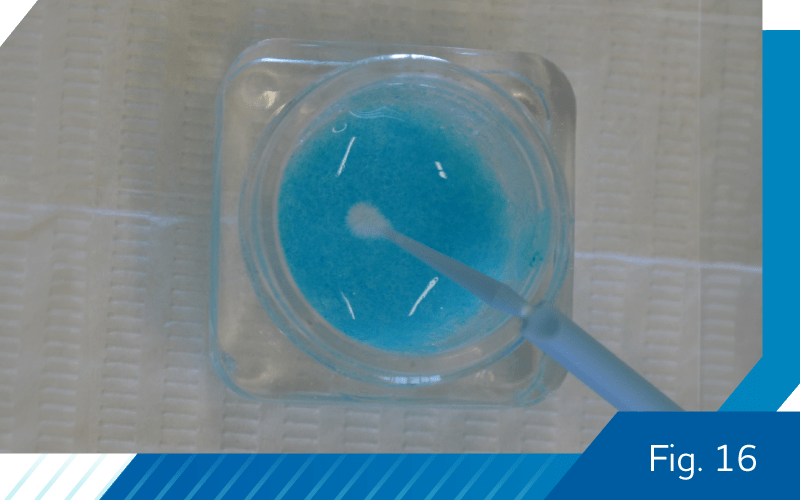 Blanqueamiento Con Pola Office Bulk Kit » Dental Para Cual