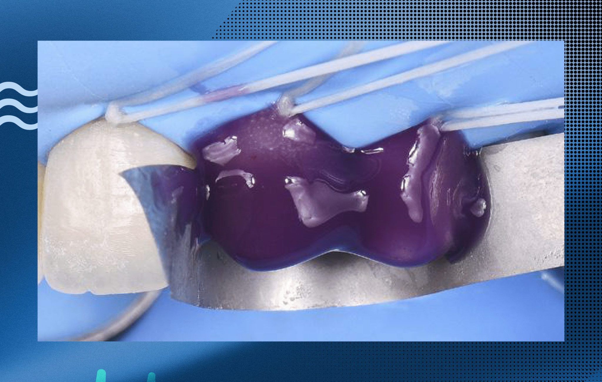 Cambio De Sonrisa Ecosite Elements » Dental Para Cual