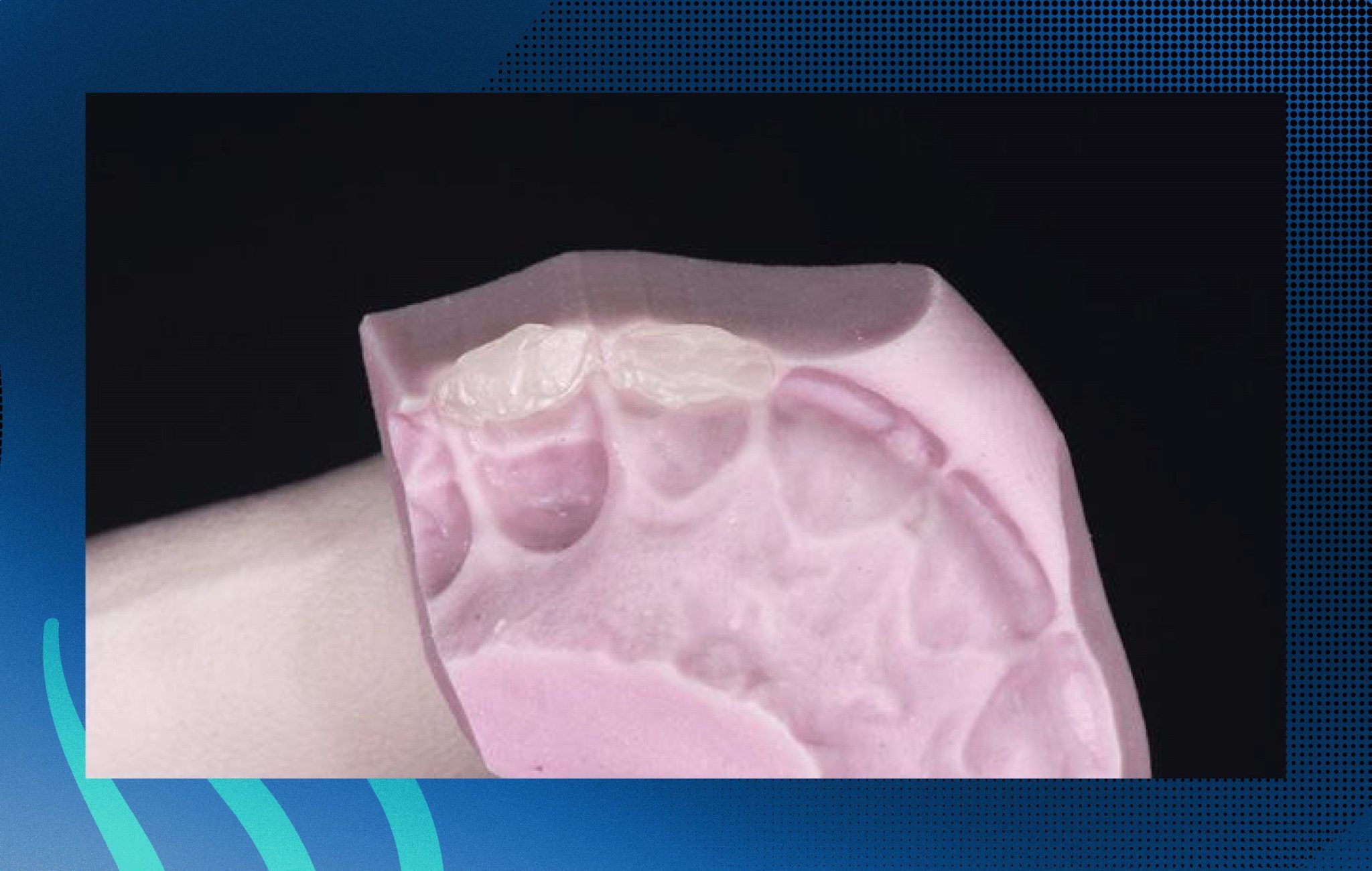 Cambio De Sonrisa Ecosite Elements » Dental Para Cual