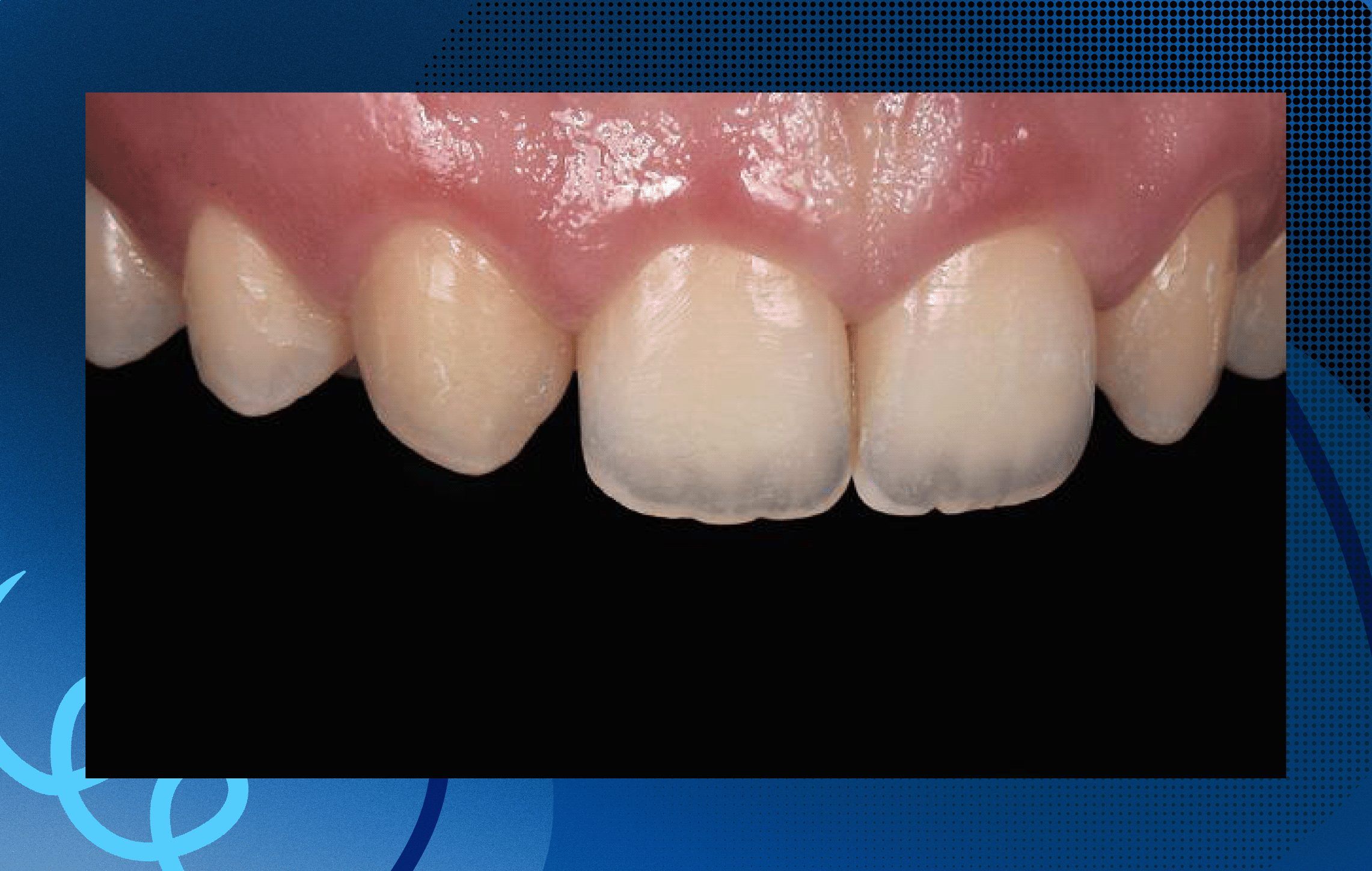 Cambio De Sonrisa Ecosite Elements » Dental Para Cual