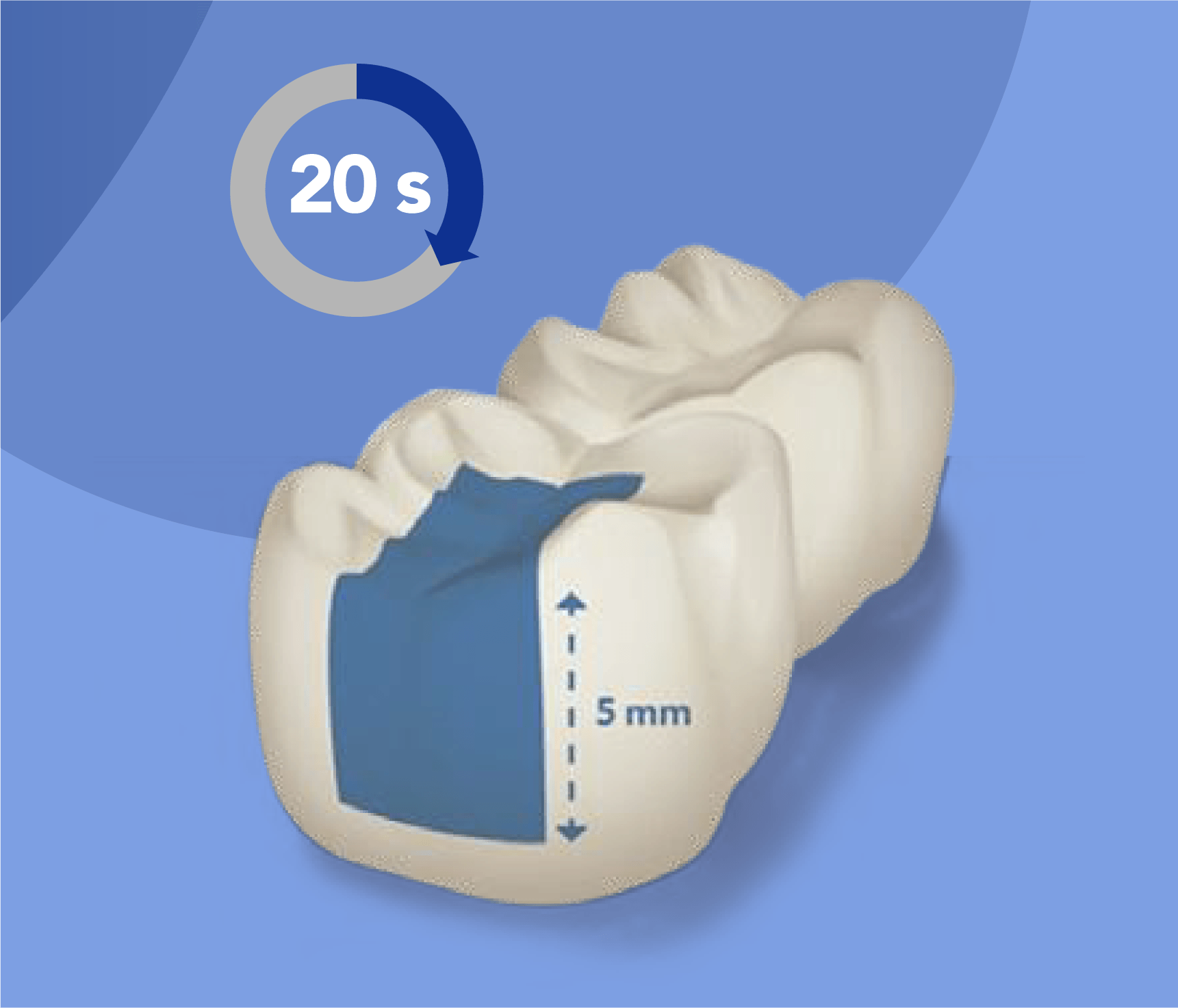 Ecosite Elements De DMG » Dental Para Cual