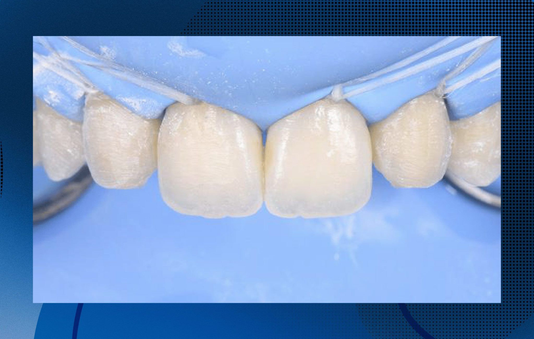 Cambio De Sonrisa Ecosite Elements » Dental Para Cual